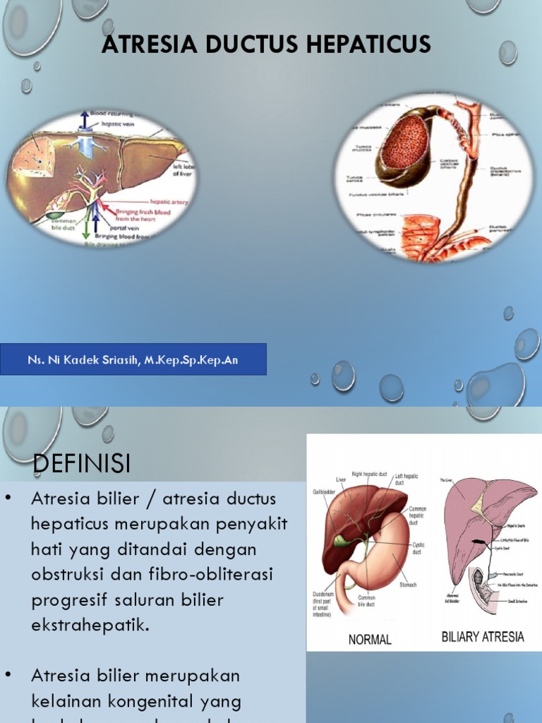 Atresia Ductus Hepaticus | PDF