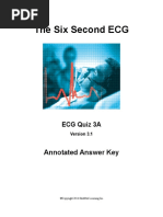 ECG Interpretation | PDF | Electrocardiography | Heart