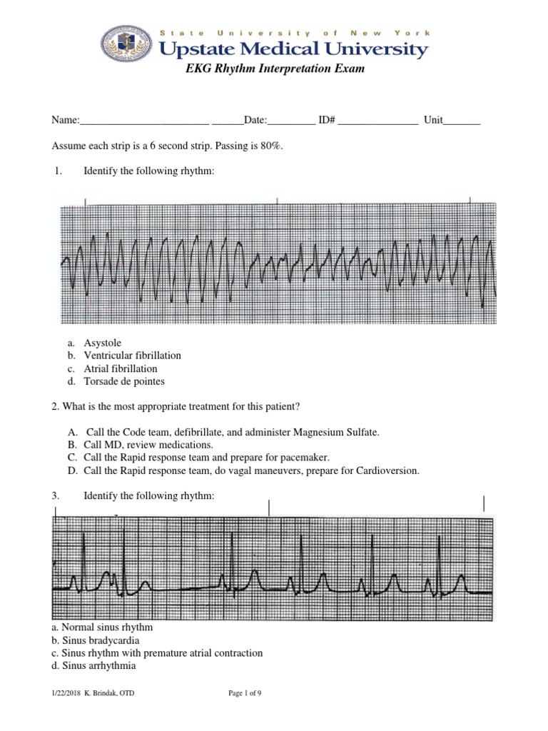 EKG Test 1 | PDF | Internal Medicine | Cardiovascular System
