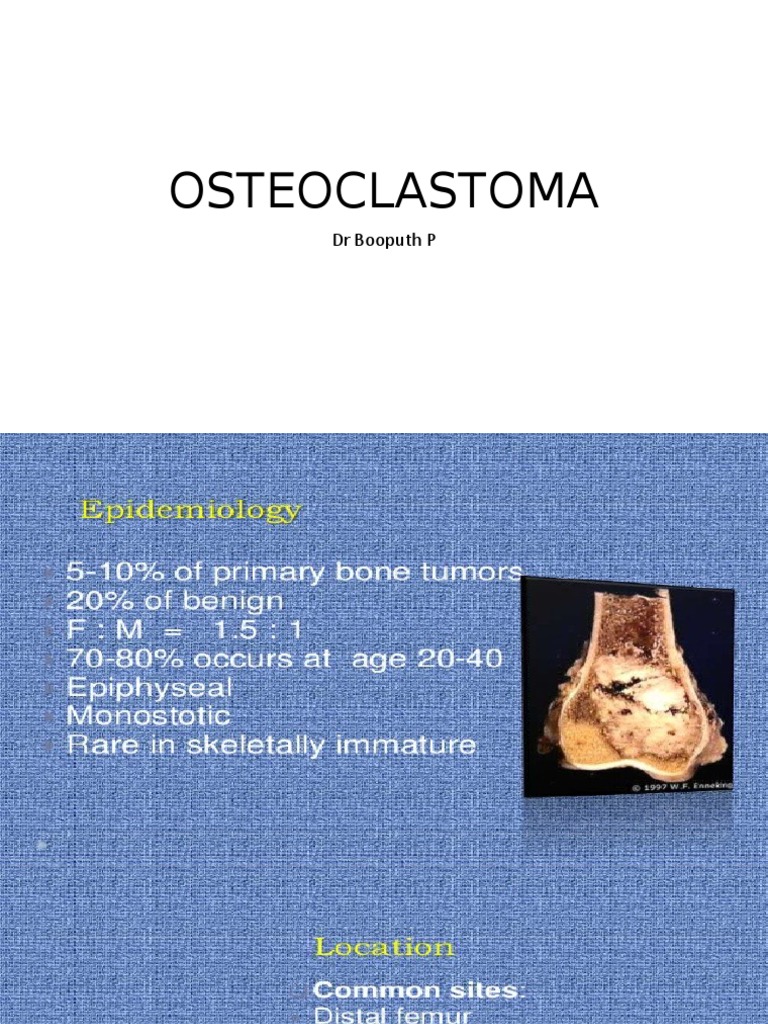 Osteoclastoma | PDF