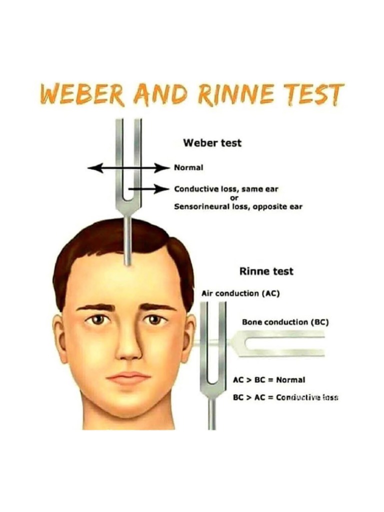 Weber and Rinne Test | PDF