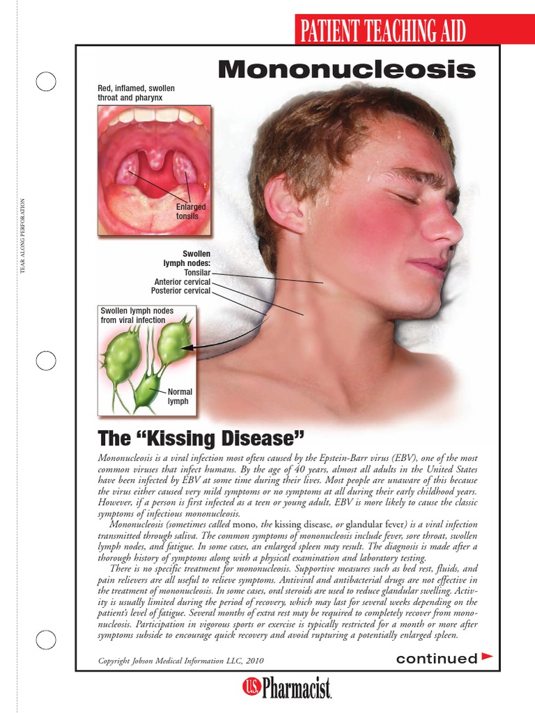 MOnonucleosis Patients Info | PDF | Infection | Medical Specialties