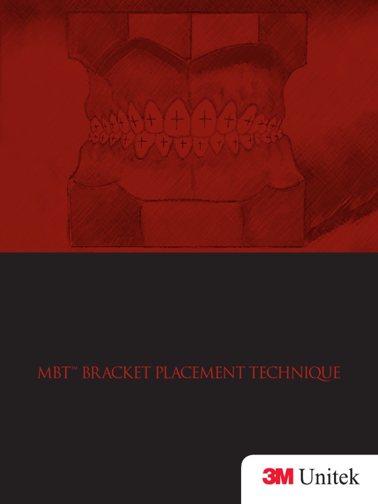 MBT Brackets Placements Technique | PDF | Tooth | Dental Anatomy