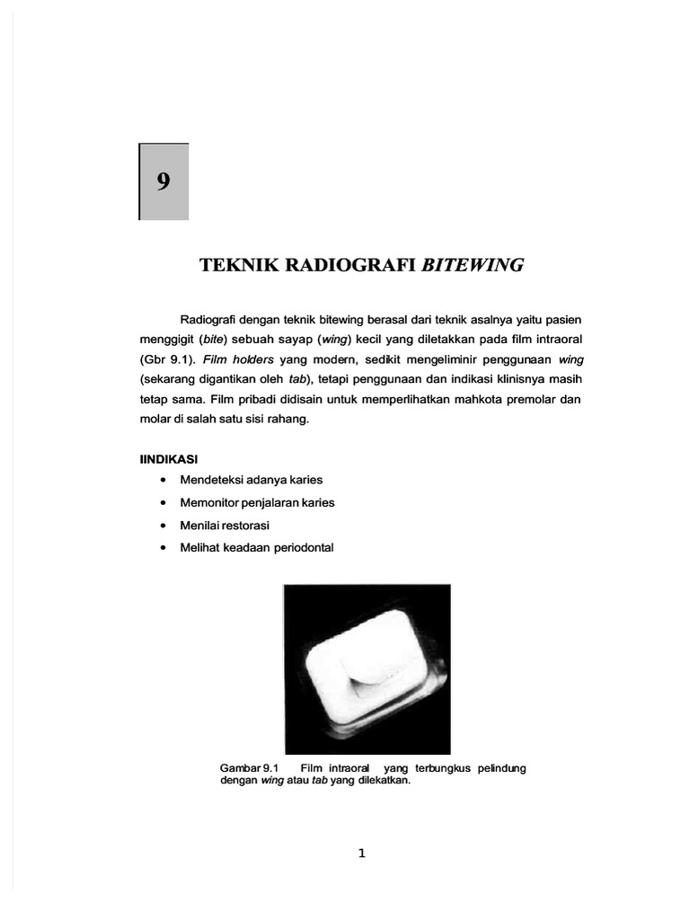 Teknik dan Indikasi Radiografi Bitewing | PDF