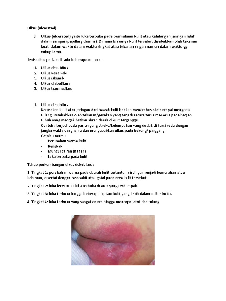 Jenis-Jenis Ulkus pada Kulit dan Penyebabnya | PDF