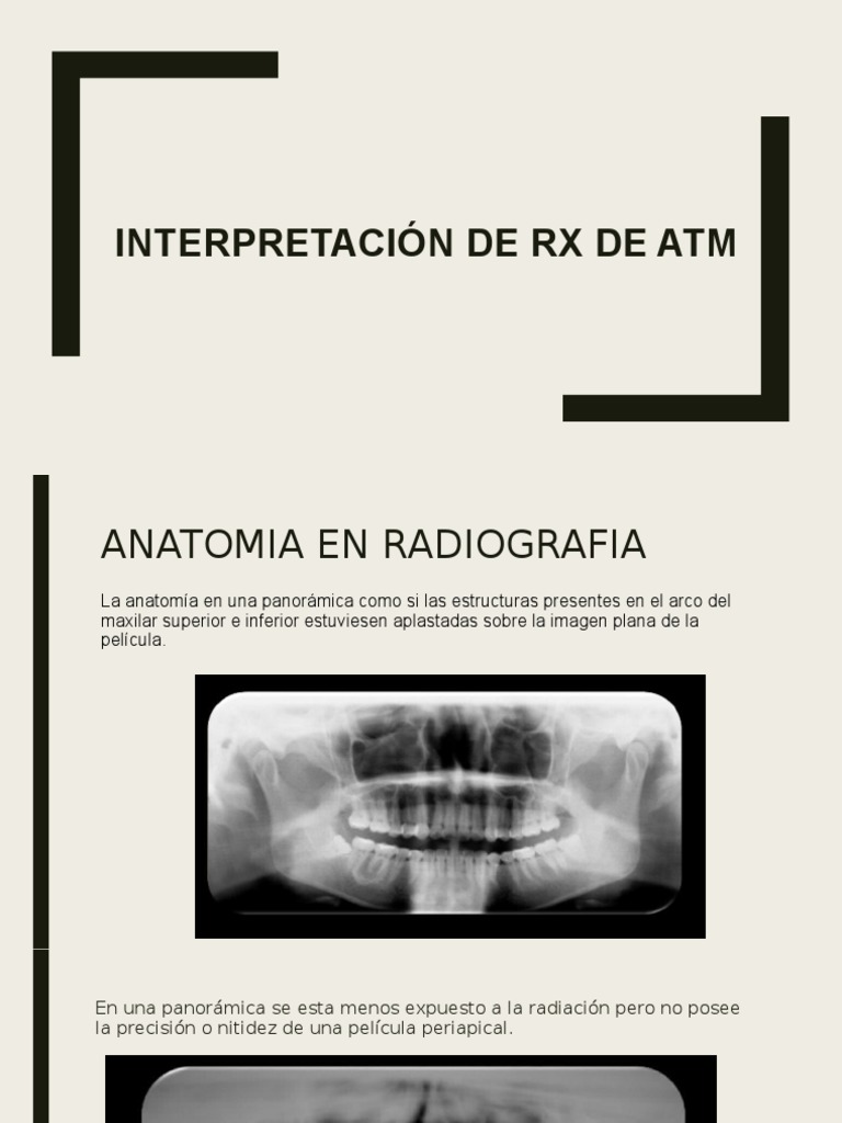 Interpretación de RX de Atm | PDF