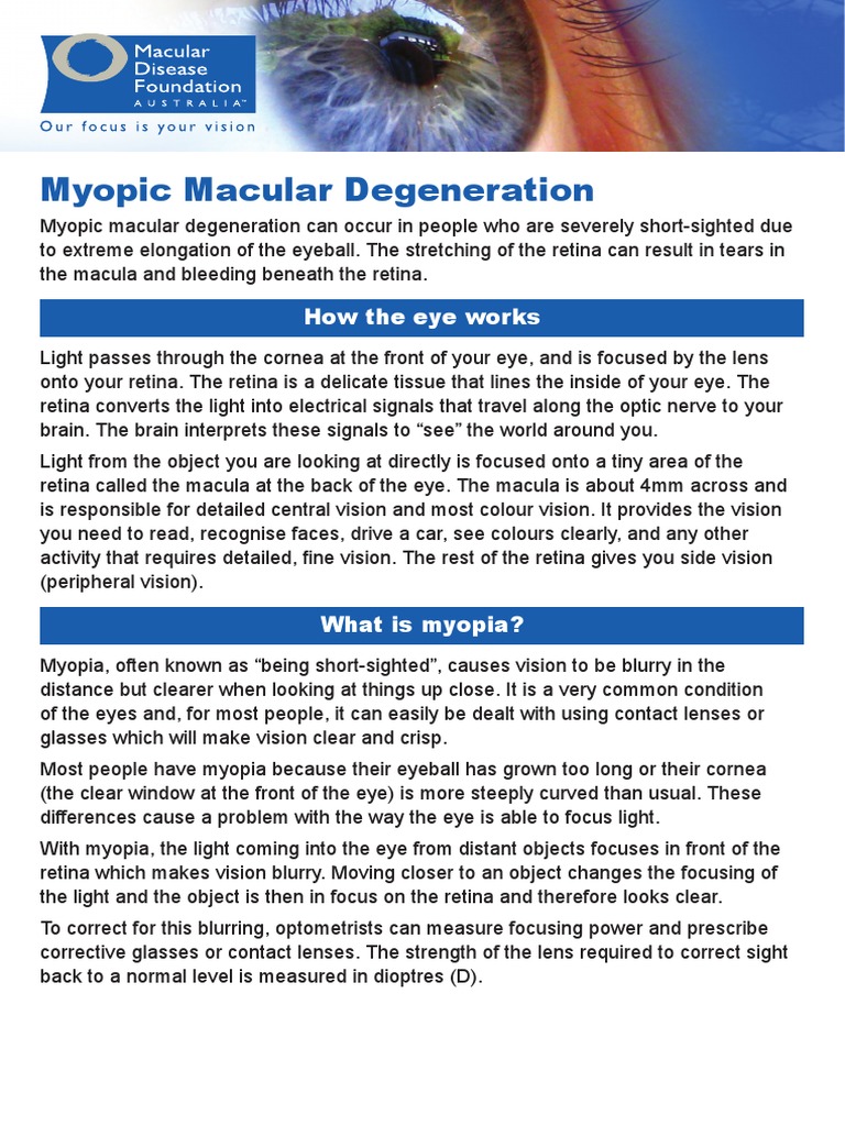 Myopic Macular Degeneration: How The Eye Works | PDF | Retina | Eye