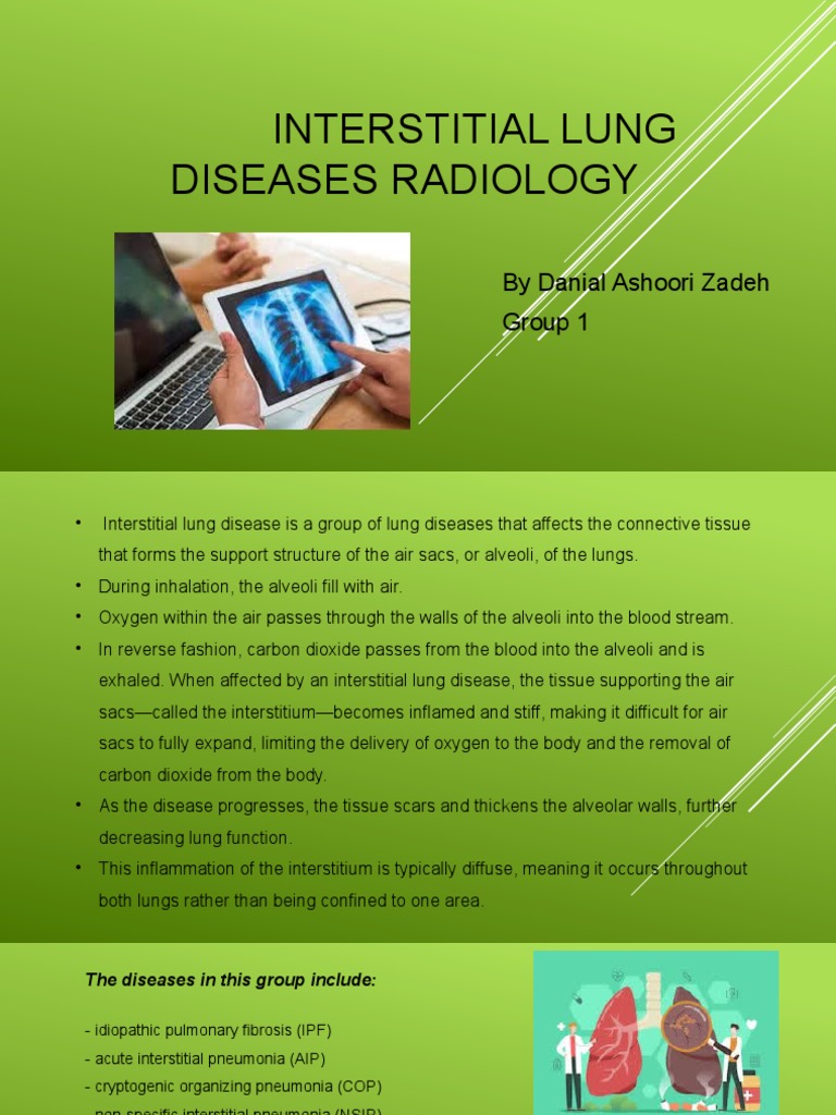 Interstitial Lung Diseases Radiology | PDF | Lung | Ct Scan