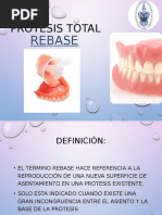 Festoneado en Prótesis Dental | PDF | Dentadura postiza | Ramas de ...