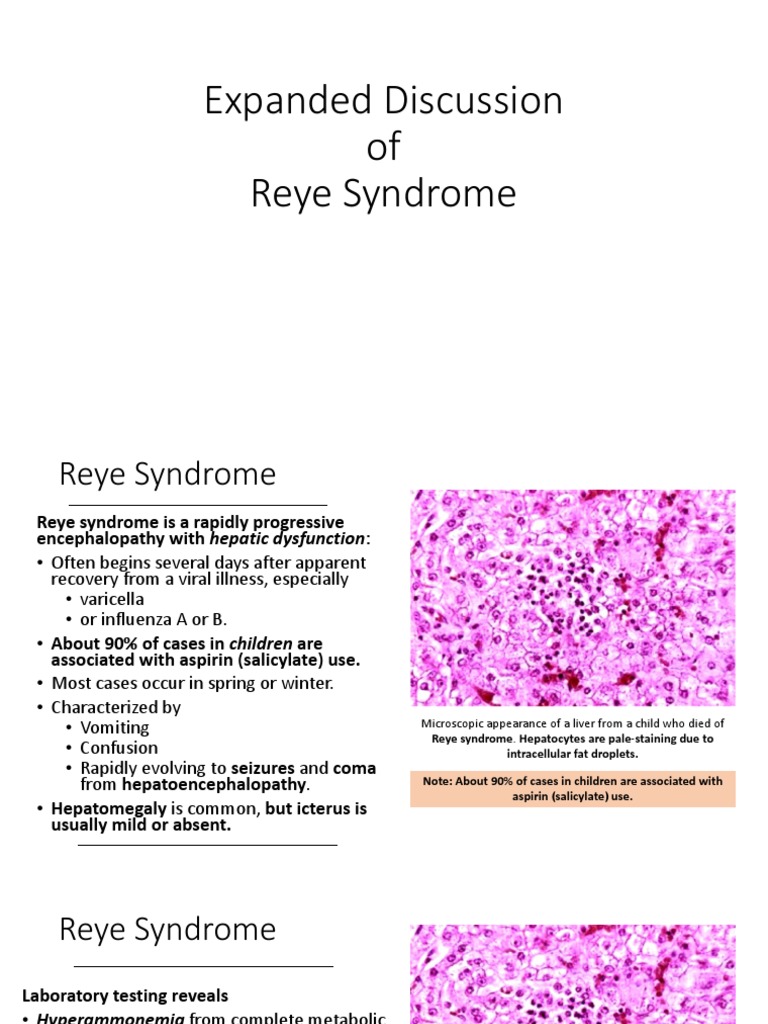 Expanded Discussion of Reye Syndrome | PDF