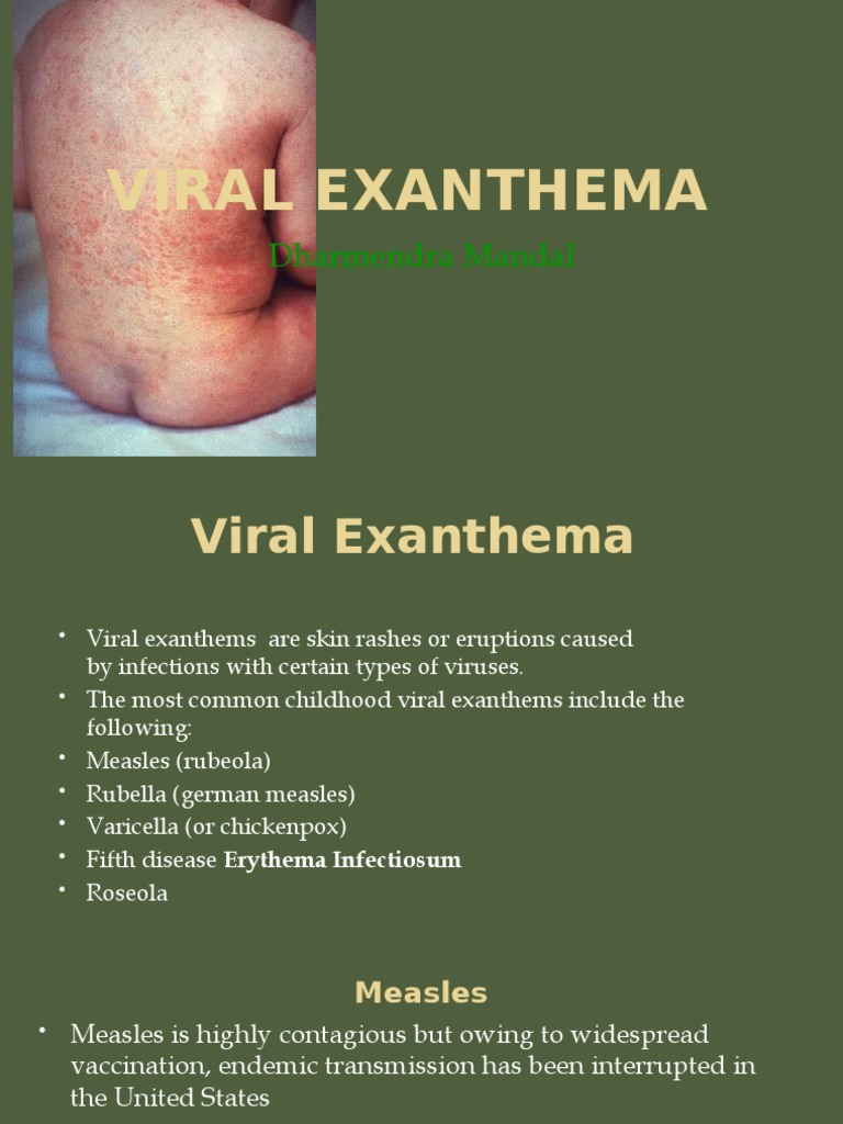 Viral Exanthema | PDF | Measles | Infection