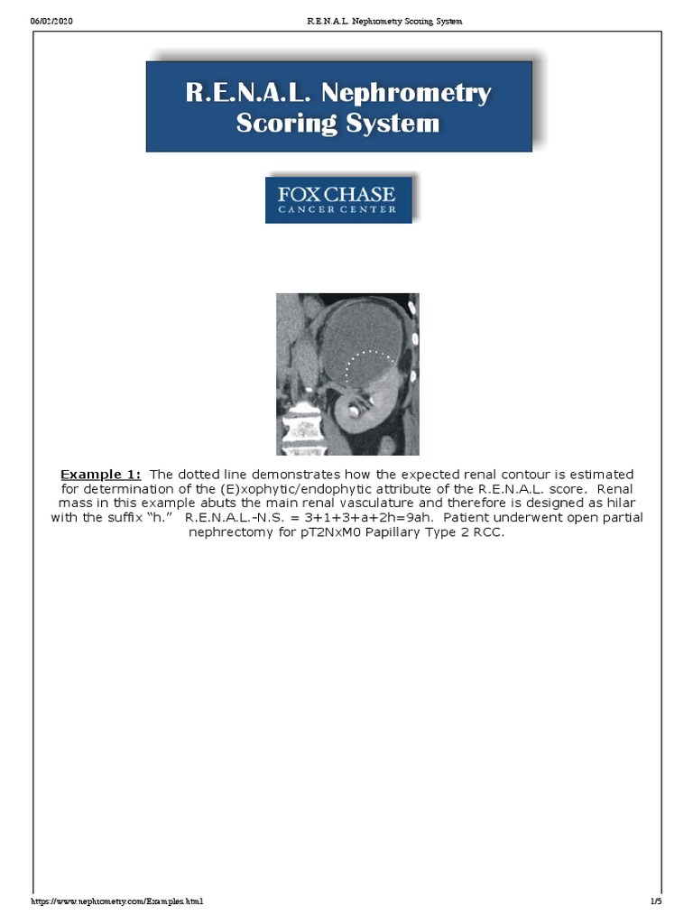 R.E.N.A.L. Nephrometry Score Examples | PDF | Kidney | Neoplasms