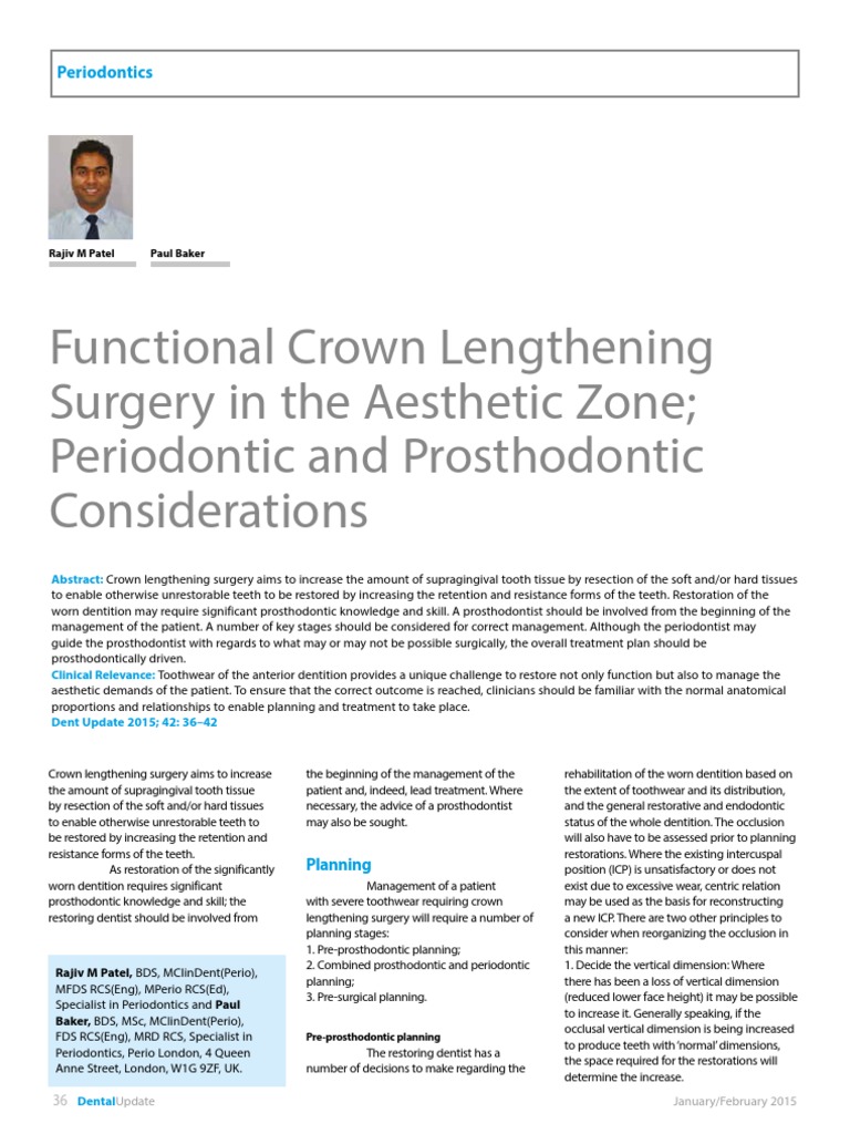Functional Crown Lengthening Surgery Periodontic and Prosthodontic ...