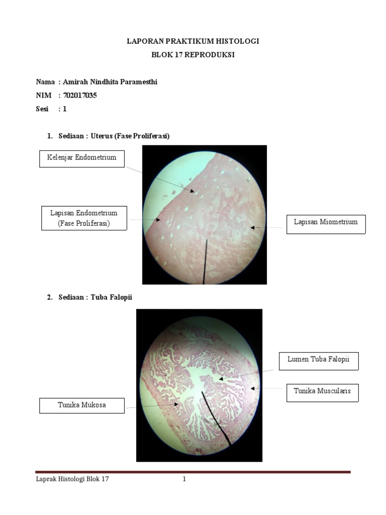 Histologi Reproduksi: Uterus & Ovarium | PDF | Ilmu Sosial | Kesehatan ...