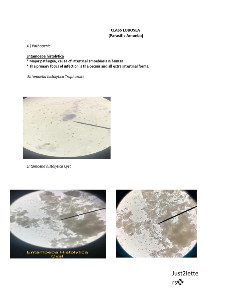 Class Lobosea (Parasitic Amoeba) : A.) Pathogenic | PDF | Plasmodium ...