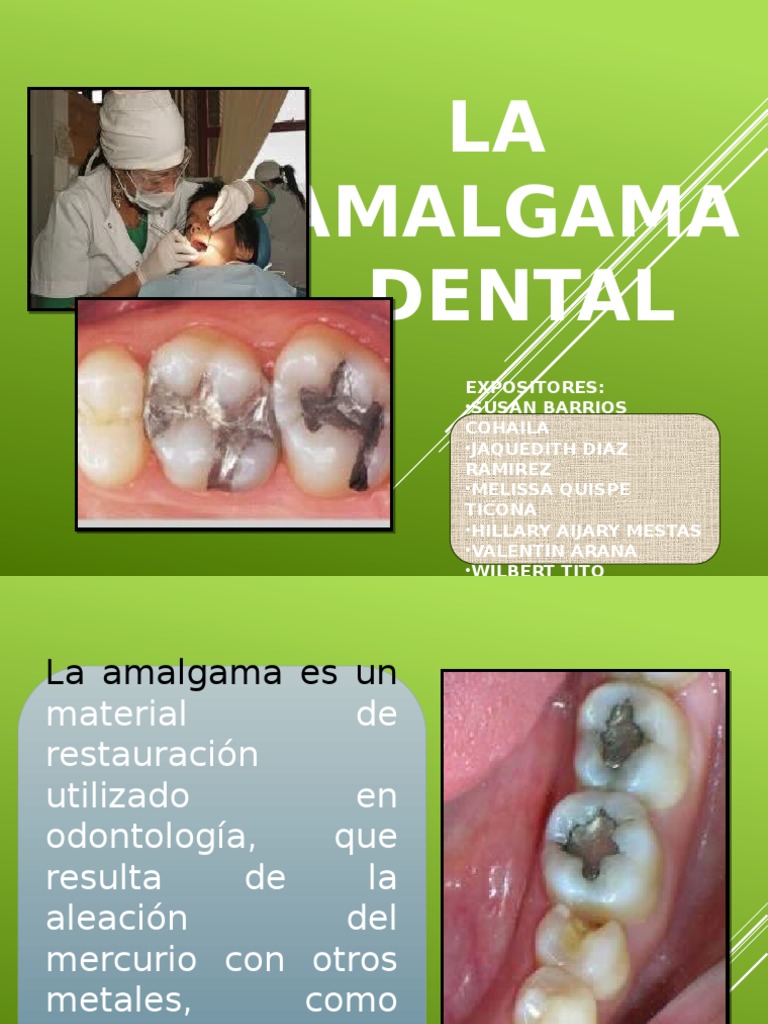 Amalgama | PDF | Aleación | Mercurio (Elemento)