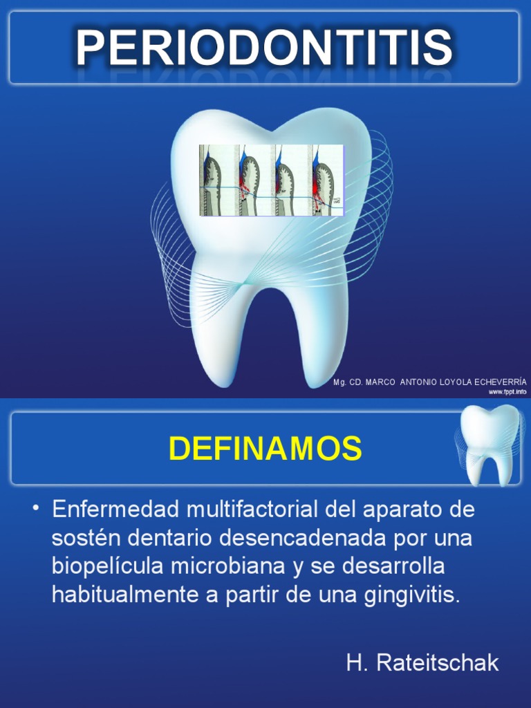 Clasificación y Tratamiento de Periodontitis | PDF | Rtt | Cuidado de ...