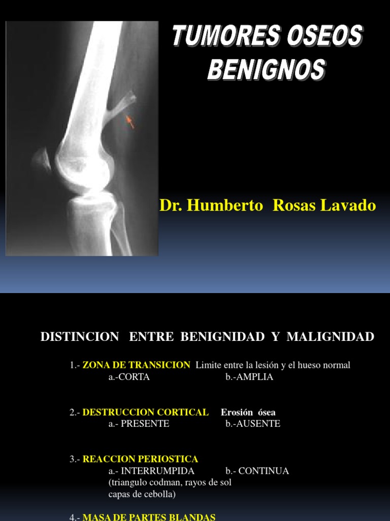 Tumores Oseos Benignos 2015 | PDF | Hueso | Neoplasias