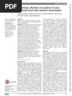 PCB00 ZCB00 Brochure PDF | PDF | Cataract | Eye