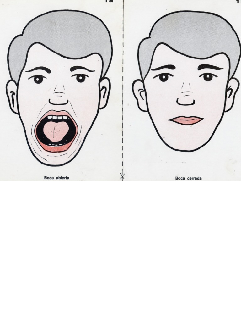 Presentación de Praxias | PDF