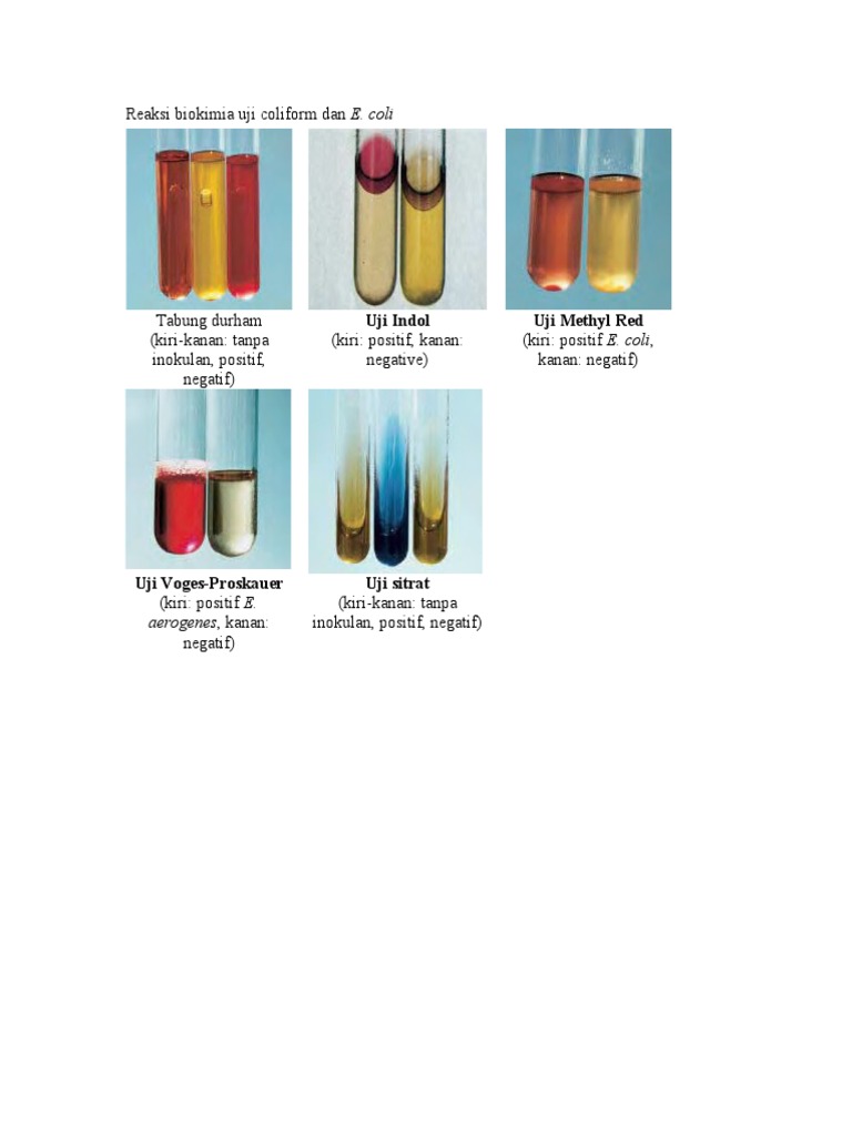 Reaksi Biokimia E. Coli | PDF