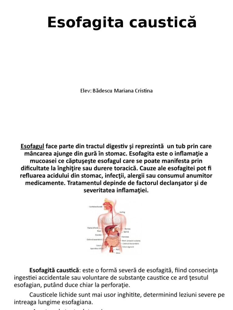 Esofagita Caustică | PDF