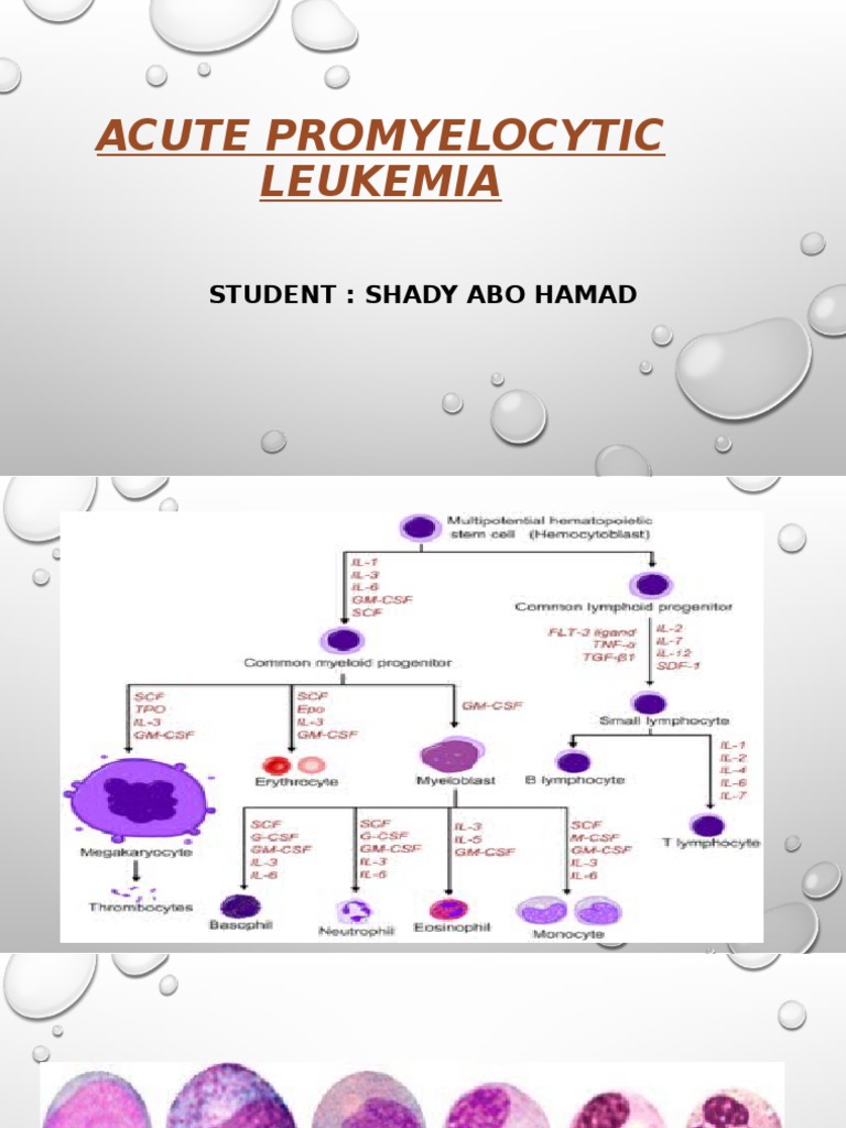 Acute Promyelocytic Leukemia | PDF