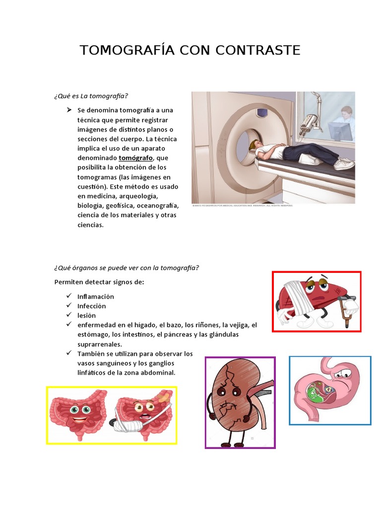 Tomografía Con Contraste | PDF | Tomografía | Ct Scan