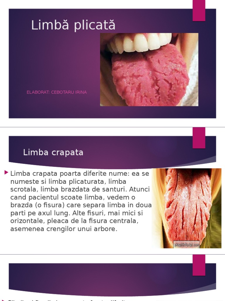 Limba Plicată. | PDF
