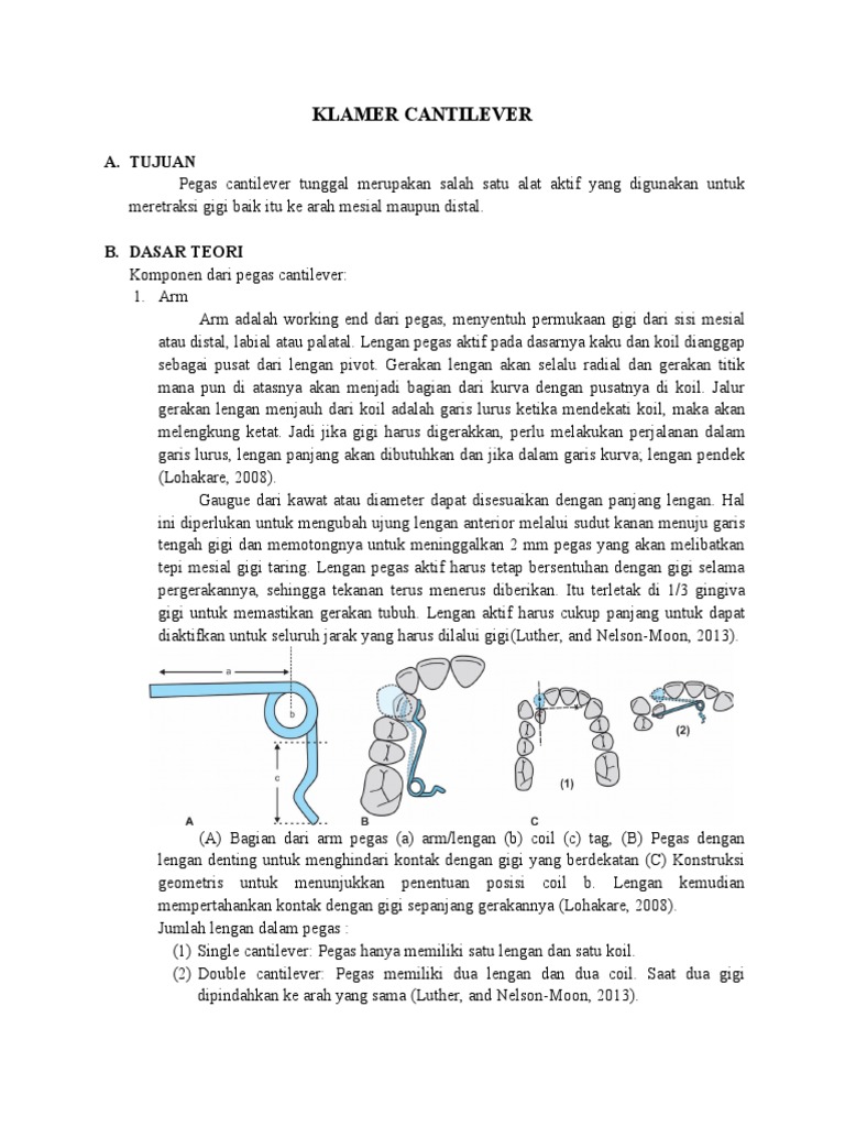Jenis dan Pembuatan Klamer Cantilever | PDF