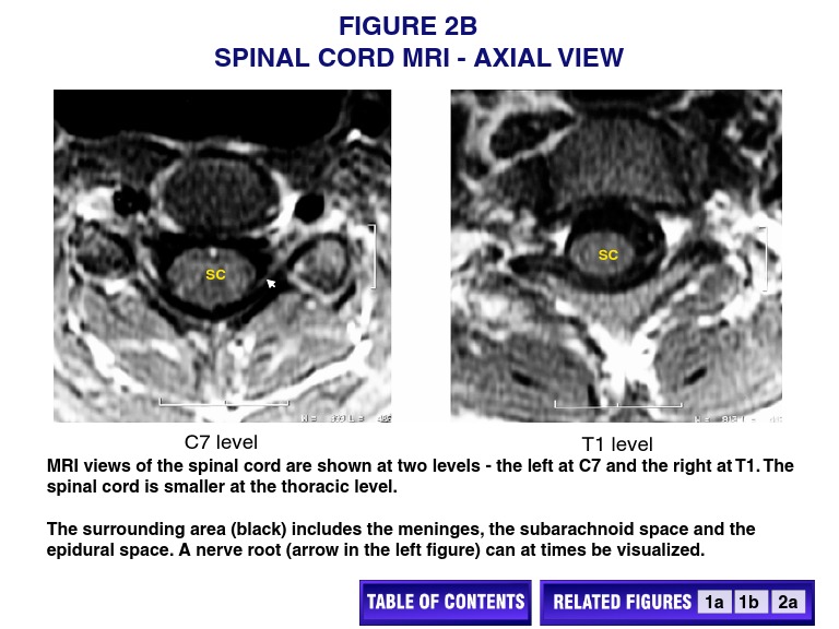 C7 Level T1 Level: SC SC | PDF