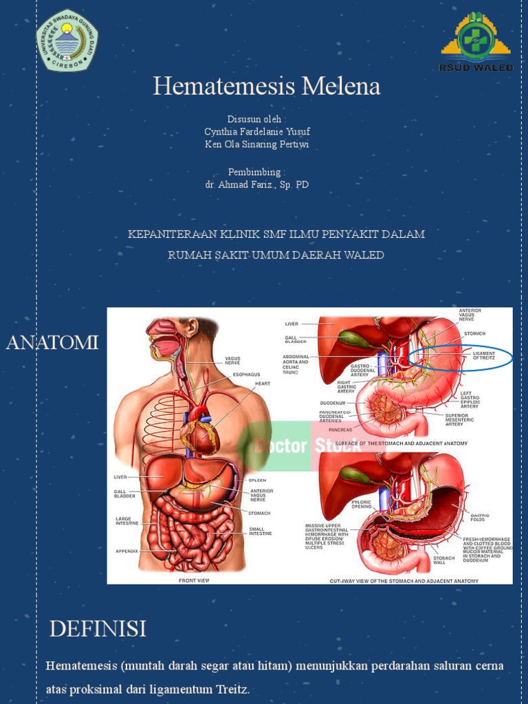 Hematemesis Melena | PDF