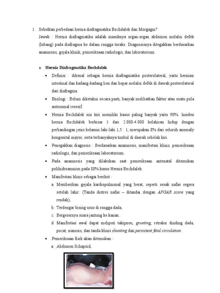 Perbandingan Hernia Bochdalek dan Morgagni | PDF