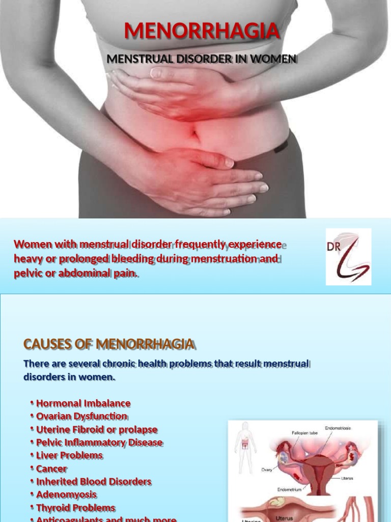 Menstrual Disorder Guide: Causes, Symptoms and Treatment of Menorrhagia ...