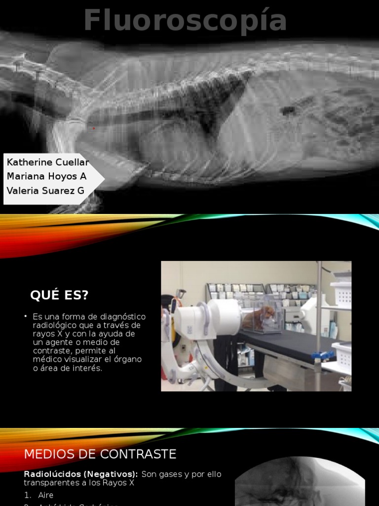 Fluoroscopia Video | PDF | Enfermedades y trastornos | Medicina