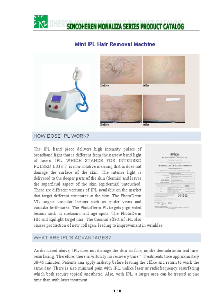 Catalogue About IPL Hair Removal Machines | PDF | Integumentary System ...