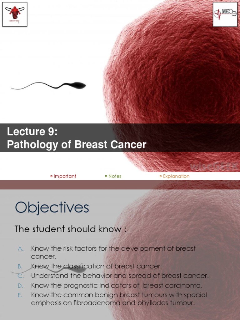 Pathology of Breast Cancer | PDF | Breast Cancer | Metastasis
