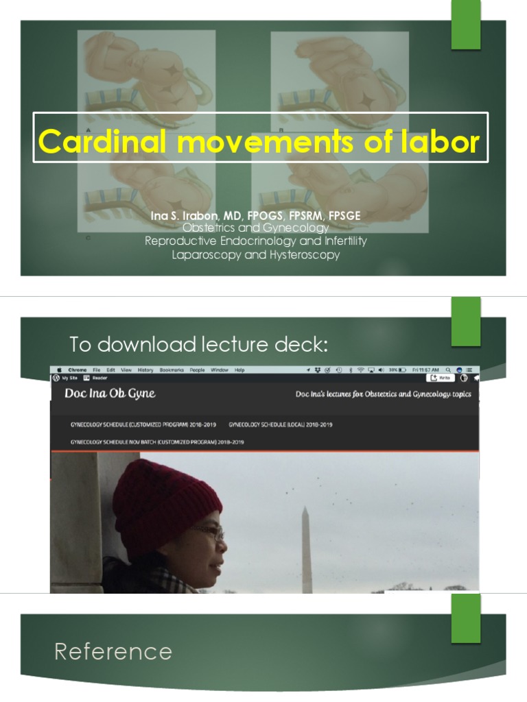 Cardinal Movements of Labor Explained | PDF | Pelvis | Childbirth