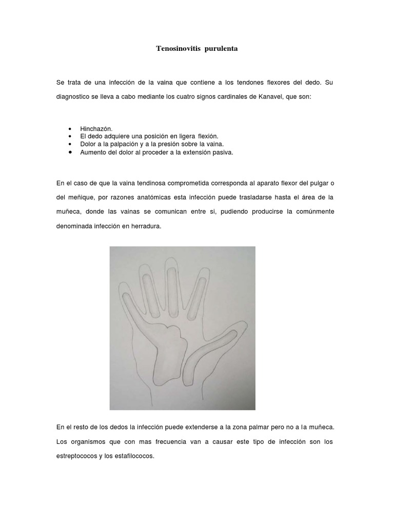 Signos de Kanavel | PDF