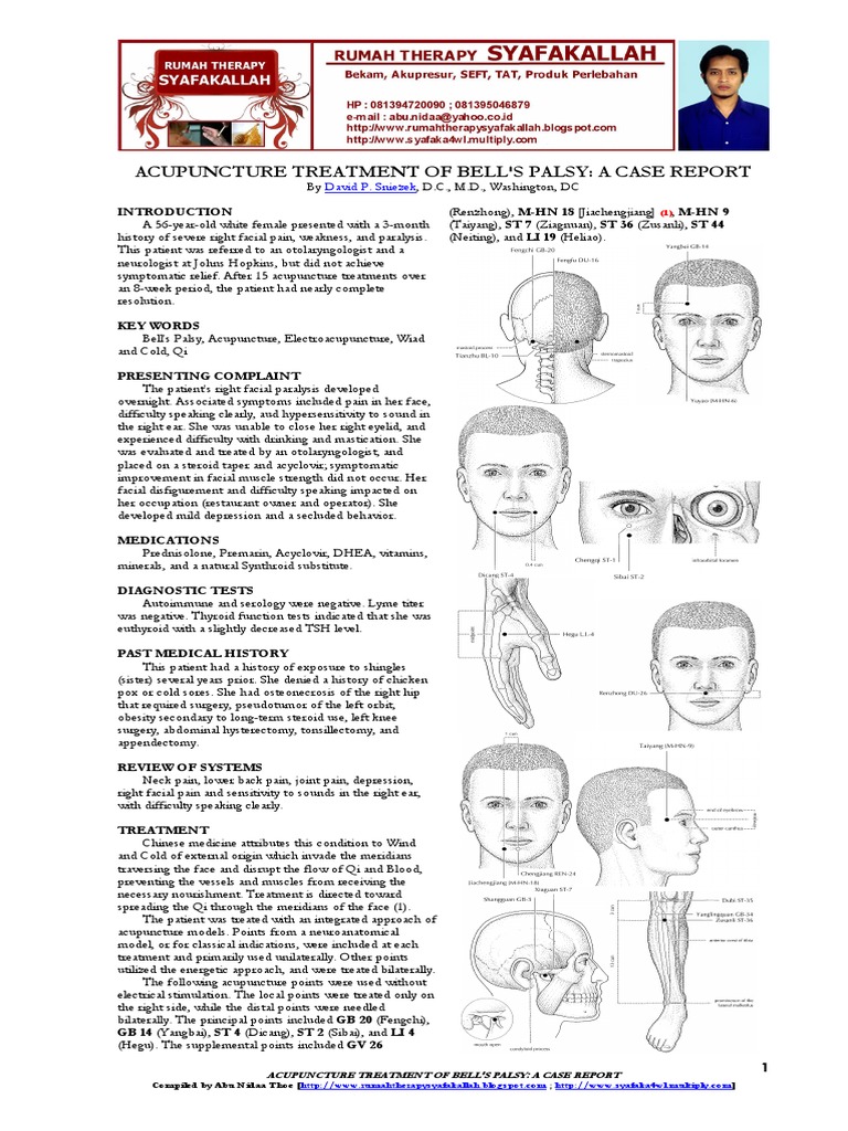 Acupuncture Treatment of Bell - S Palsy | PDF | Acupuncture | Pain