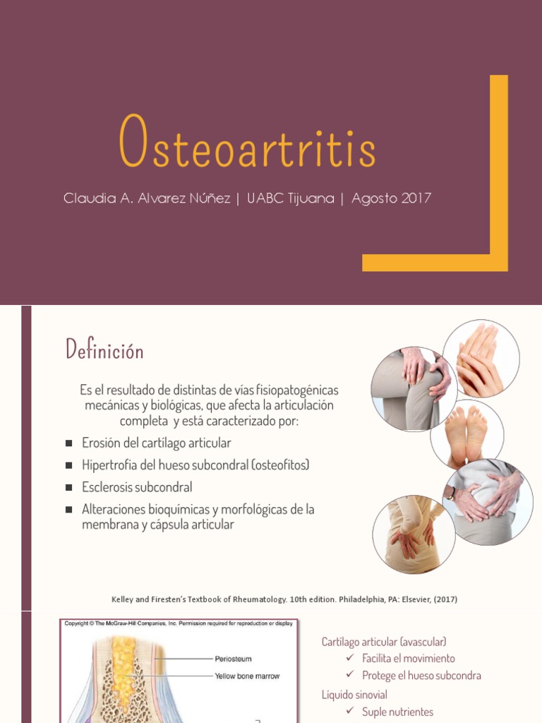 Osteoartritis Presentacion PDF | PDF | Articulación | Cartílago