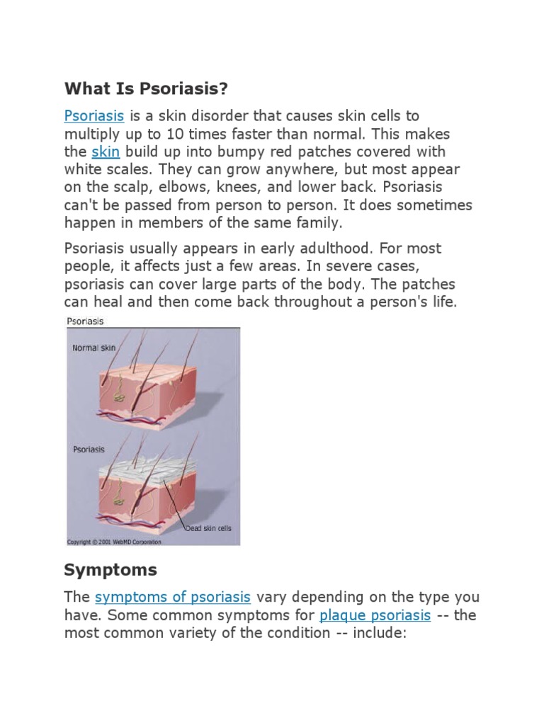 What Is Psoriasis | PDF | Psoriasis | Medical Specialties