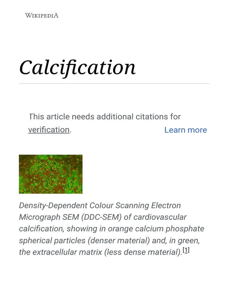 Calcification | PDF | Medical Specialties | Diseases And Disorders