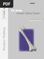 T2 Proximal Humeral Nailing System - Stryker | PDF | Screw | Orthopedic Surgery