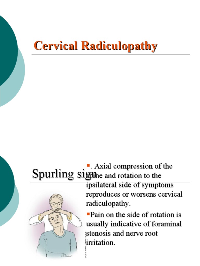3-Cervical Radiculopathy | PDF | Arm | Pain