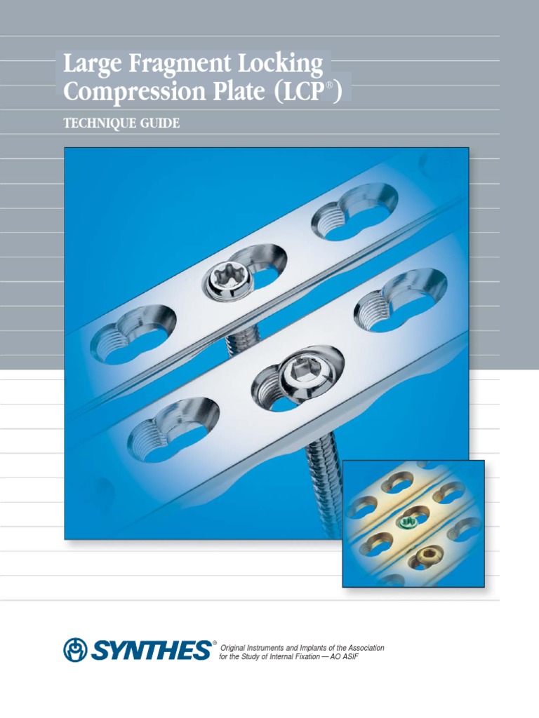 Large Fragment Locking Compression Plate Lcp Technique Guide Pdf