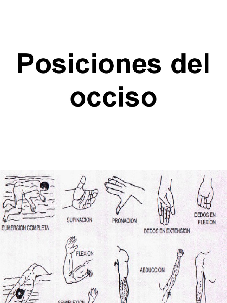 Posiciones Del Occiso | PDF