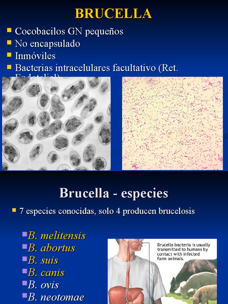 brucella | Biología Celular | Medicina CLINICA | Prueba gratuita de 30 ...