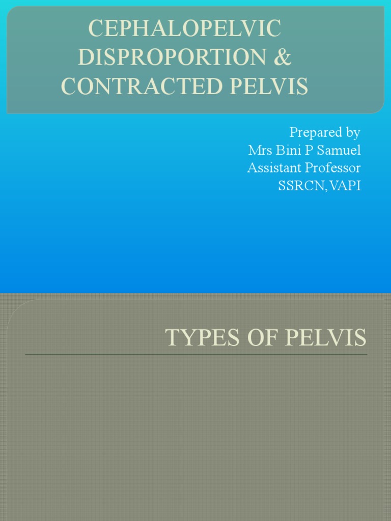 Cephalo Pelvic Disproportion (CPD) & Contracted Pelvis | PDF | Pelvis ...