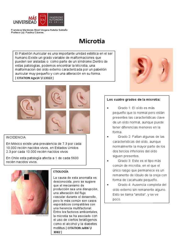 Microtia | PDF | Enfermedades y trastornos humanos | Epidemiología